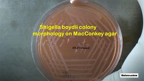 Shigella Species Introduction Morphology Culture Characteristics