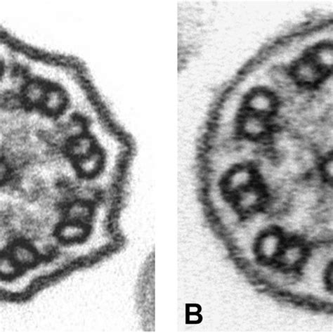 A Ultrastructure Of A Normal Cilium From Nasal Epithelium Of A Healthy Download Scientific
