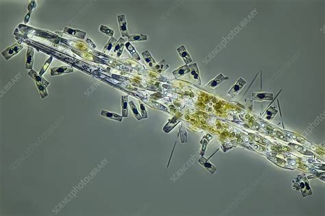 Diatoms Light Micrograph Stock Image C0168600 Science Photo Library