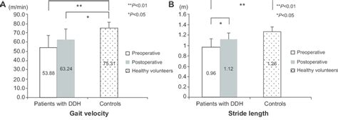 Temporospatial Gait Parameters Of Patients With Ddh Pre And