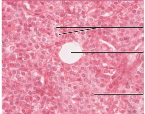 Parathyroid Tissue Quiz