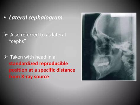 Lateral Cephalometry In Orthodontics Pptx