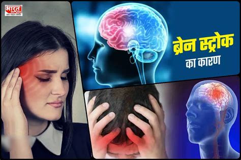 Brain Stroke मरीजों के लिए क्या है गोल्डन पीरियड कैसे करें बचाव जानिए