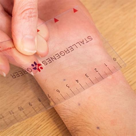 Allergywetakeitpersonally Allergies Respiratoryallergy Foodallergy Insectvenomallergy