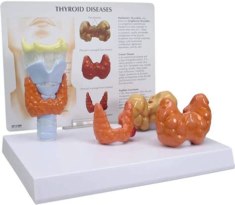 Buy Lbylyh Thyroid System Model Of The Human Body Anatomy Thyroid