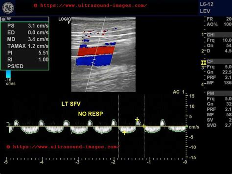 A Gallery Of High Resolution Ultrasound Color Doppler And 3d Images