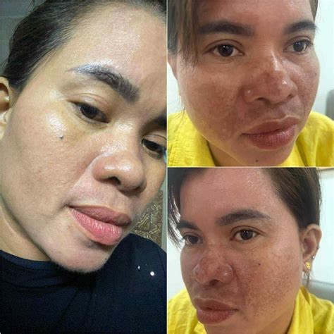 ក្រុមហ៊ុ ក្រុមហ៊ុន ផាលីតា ត្រេឌីង ឯក Phalita Skin Care