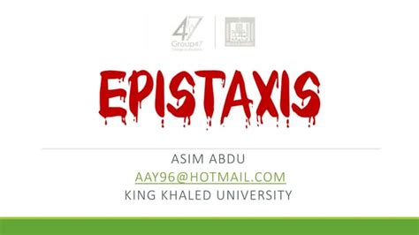 Epistaxis Ppt