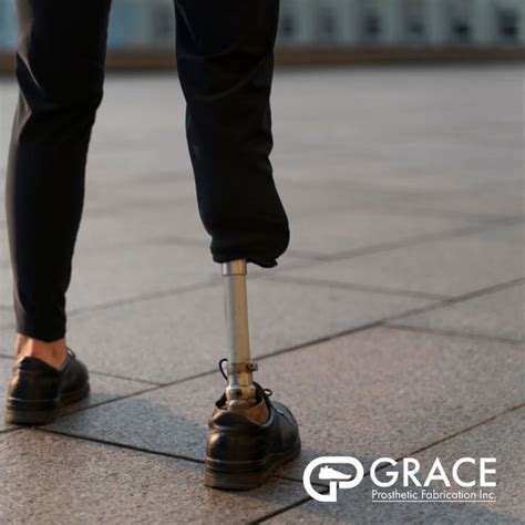 How Doctors Can Work With Prosthetists