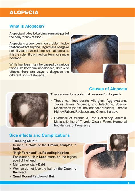 The Causes And Solutions For Balding Ask The Nurse Expert