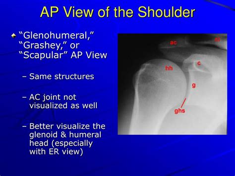 Ppt X Ray Rounds Plain Radiographic Evaluation Of The Shoulder