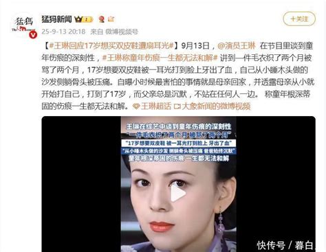 王琳自曝17岁时想买一双皮鞋，妈妈一耳光打到自己牙出血 360娱乐，你开心就好