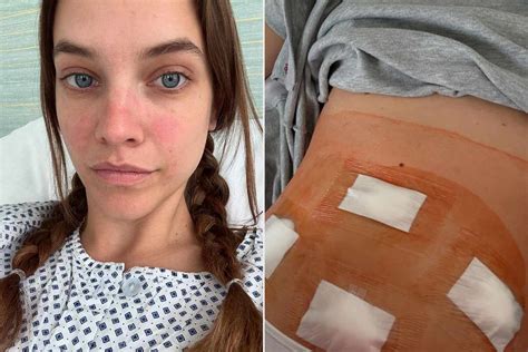 Barbara Palvin Revealed She Underwent Surgery For Endometriosis