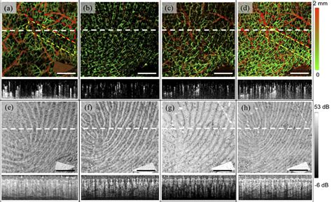 Figure 1 From Polarization Sensitive Optical Coherence Tomography For Imaging Microvascular