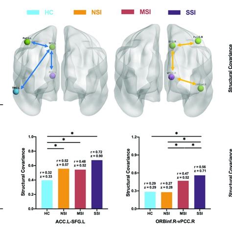 Comparison Of Con Structural Covariance Network Left Side Compared