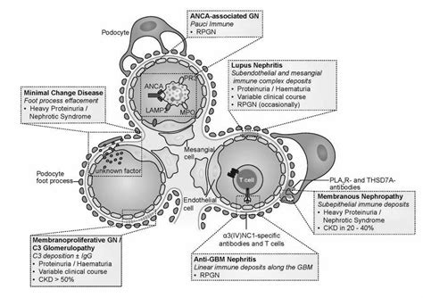Hematogones An Illustration Of The Common Types Of