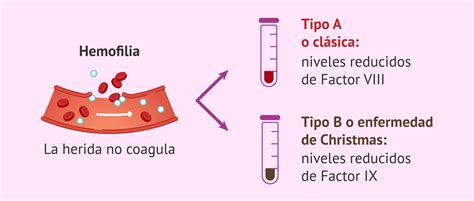 Dos Tipos De Hemofilia