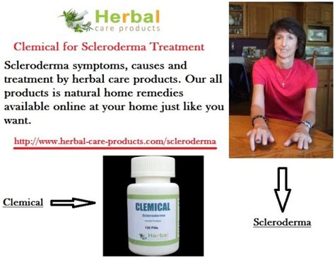 Scleroderma Treatment Herbal Care Products Blog