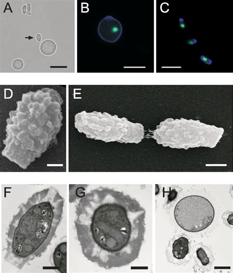 Isolation And Characterization Of Cryptococcus Neoformans Spores Reveal A Critical Role For