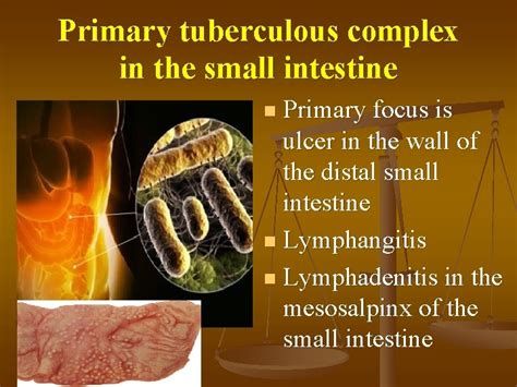 Tuberculosis Is Infectious Contagious Disease Caused By Mycobacterium