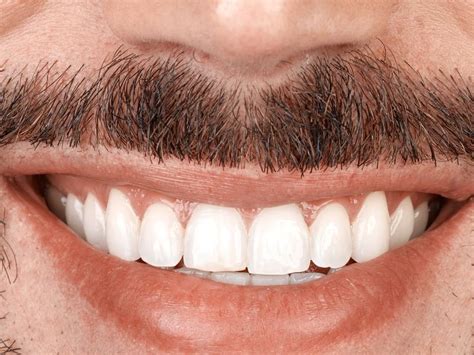 Dental Extraction Post Operative Instructions And Recovery Guidelines