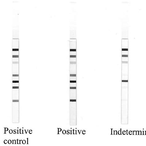 Confirmation Of Tpha Results By Inno Lia Syphilis A Tpha No Of Samples