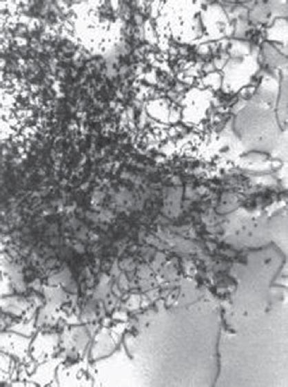 9 Dislocation Network Surrounding A Te Inclusion In Cdznte Shown By