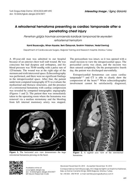 Pdf A Retrosternal Hematoma Presenting As Cardiac Tamponade After A