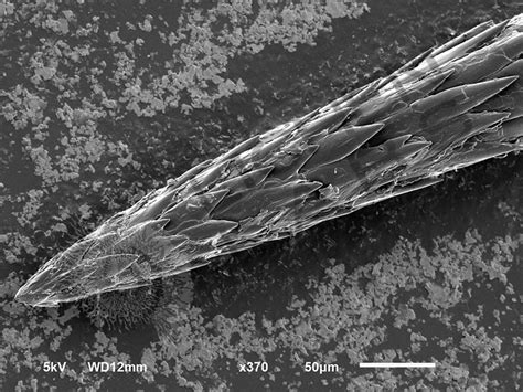 Porcupine Quills Microscope