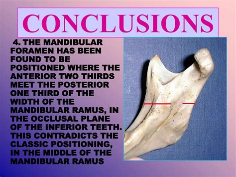 The Mandibular Foramen Role Of Its Position In Block Anaesthesia Ppt