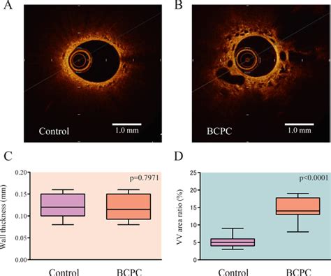 Fontan Operation Plos One