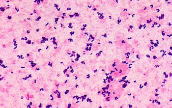Corynebacterium Pseudodiphteriticum