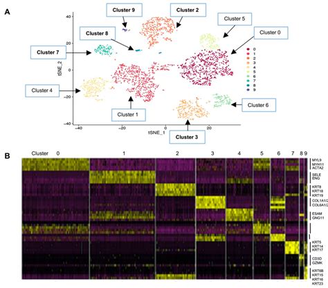 Single Cell Clusters Matching To The Breast Cancer Subtypes A Heat
