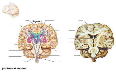 Interior Anatomy Of Telencephalon Diagram Quizlet