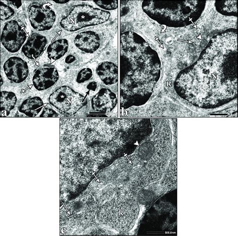 An Electron Micrograph In The Thymic Cortex Of A Control Rat Group І