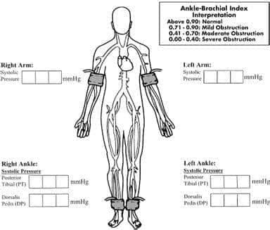 The Ankle Brachial Index Abi Calculator