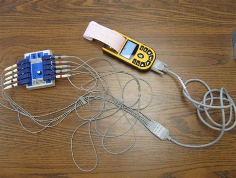 Comparison Of Handheld 1 Lead Ecg Ekg Recorders