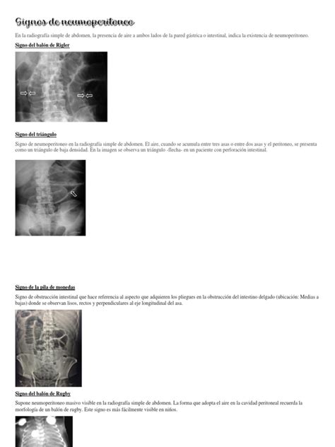 Signos De Neumoperitoneo Pdf Abdomen Hígado