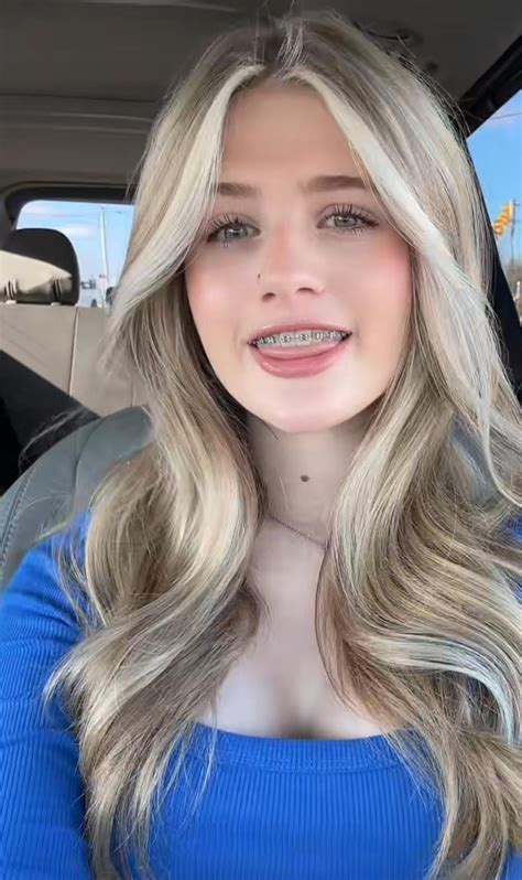 Am I Hot Enough To Pull Off Braces Rbracesporn