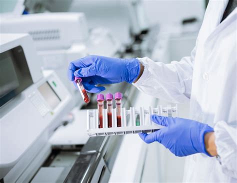 Maintenance Guidelines For Hematology Analyzers Chemtronics