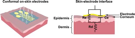 The Skin‐electrode Interface Model Of On‐skin Electrodes Download Scientific Diagram