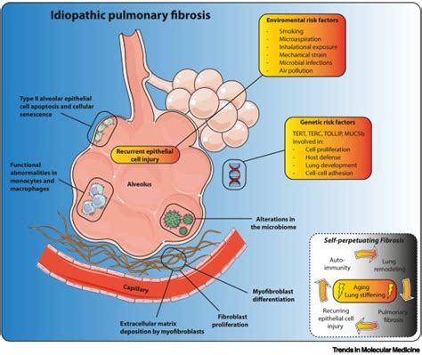 Pulmonary Fibrosis From Pathogenesis To Clinical Decision Making