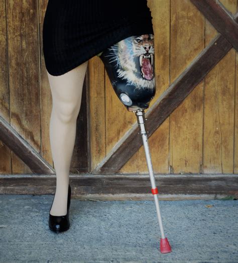 29 Pegleg Ideas In 2025 Amputee Bionic Woman Amputee Lady