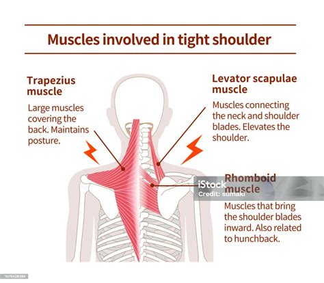 Muscle Sets In The Back That Cause Tight Shoulder Stock Illustration