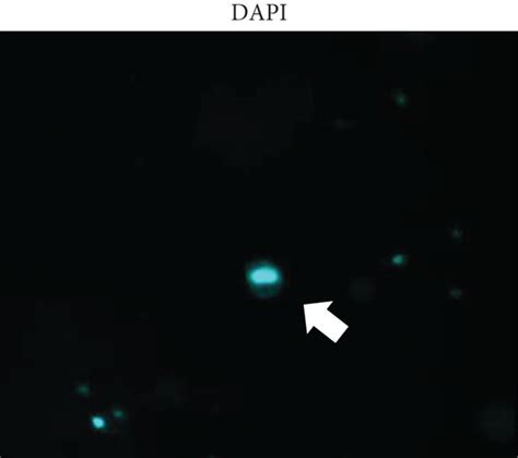 A Urinary Podocytes Were Incubated With Anti Human Podocalyxin