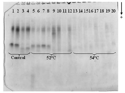 Thermostability Profile Of The Esterase Isoenzymes In The Page System