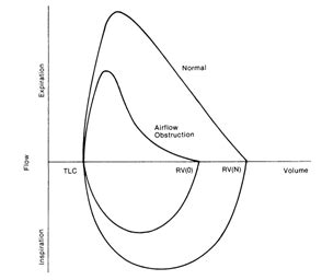 Pulmonary Function Testing Clinical Respiratory Diseases And Critical