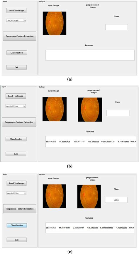 Proposed Technique Matlab Gui Windows A Test Retinal Fundus Image Load Download Scientific