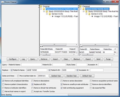 How To Anonymise A Dicom File From Ct And Mri Scan Images