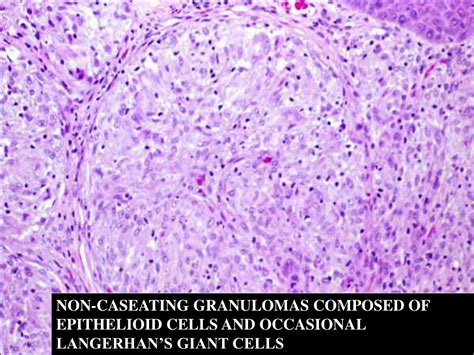 Ppt Monocytemacrophage Disorders Powerpoint Presentation Free